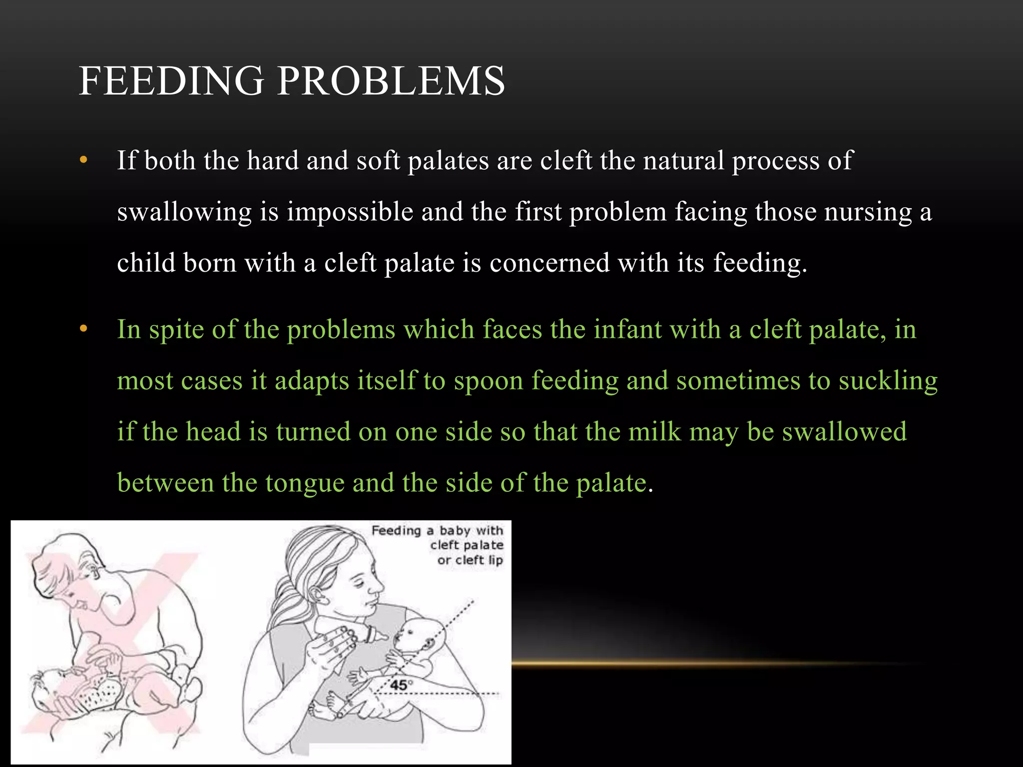 Cleft lip and palate rehabilitation - Dr Prathibha Prasad | PPTX | Pregnancy | Reproductive Health