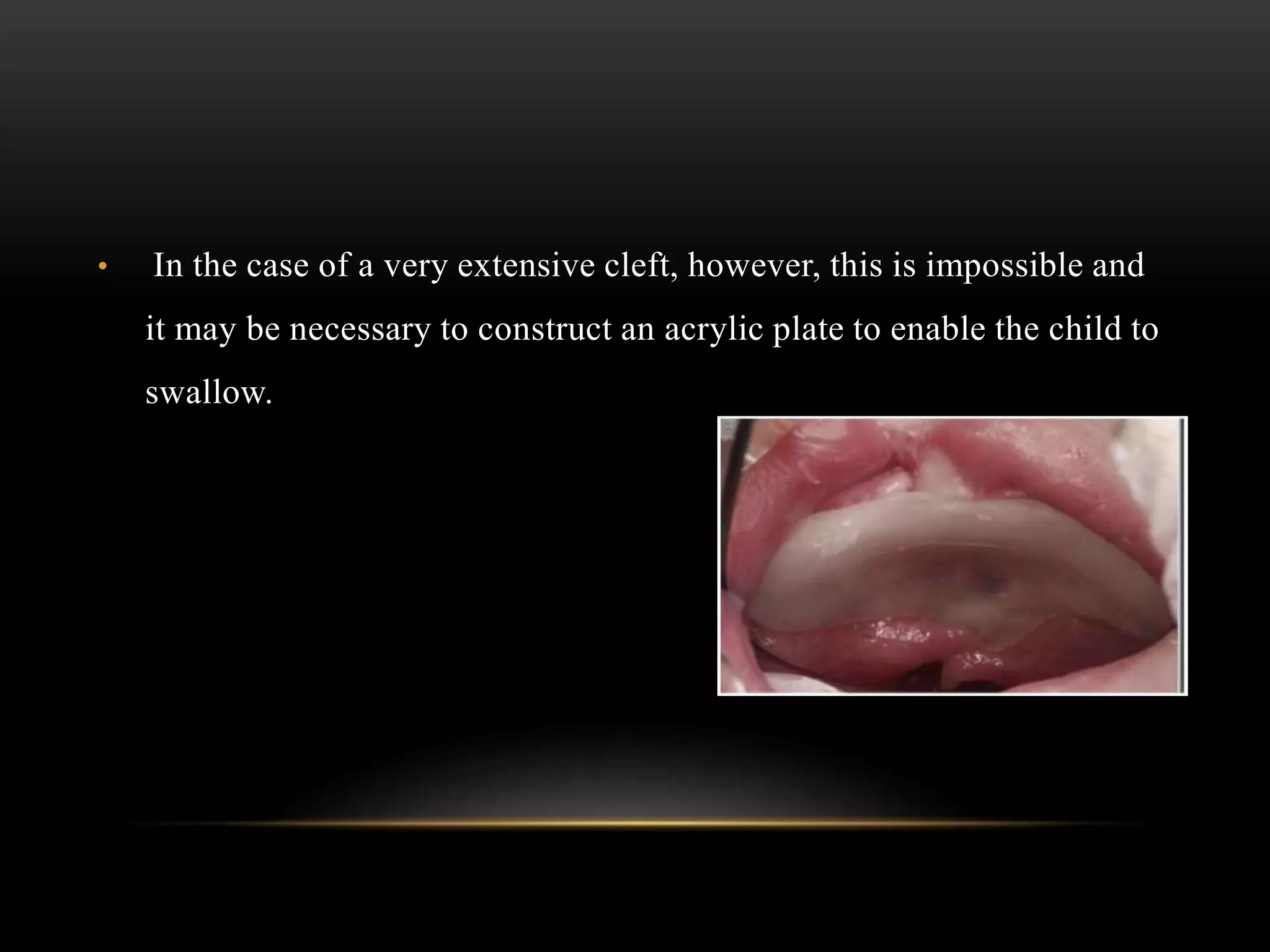 Cleft lip and palate rehabilitation - Dr Prathibha Prasad | PPTX | Pregnancy | Reproductive Health