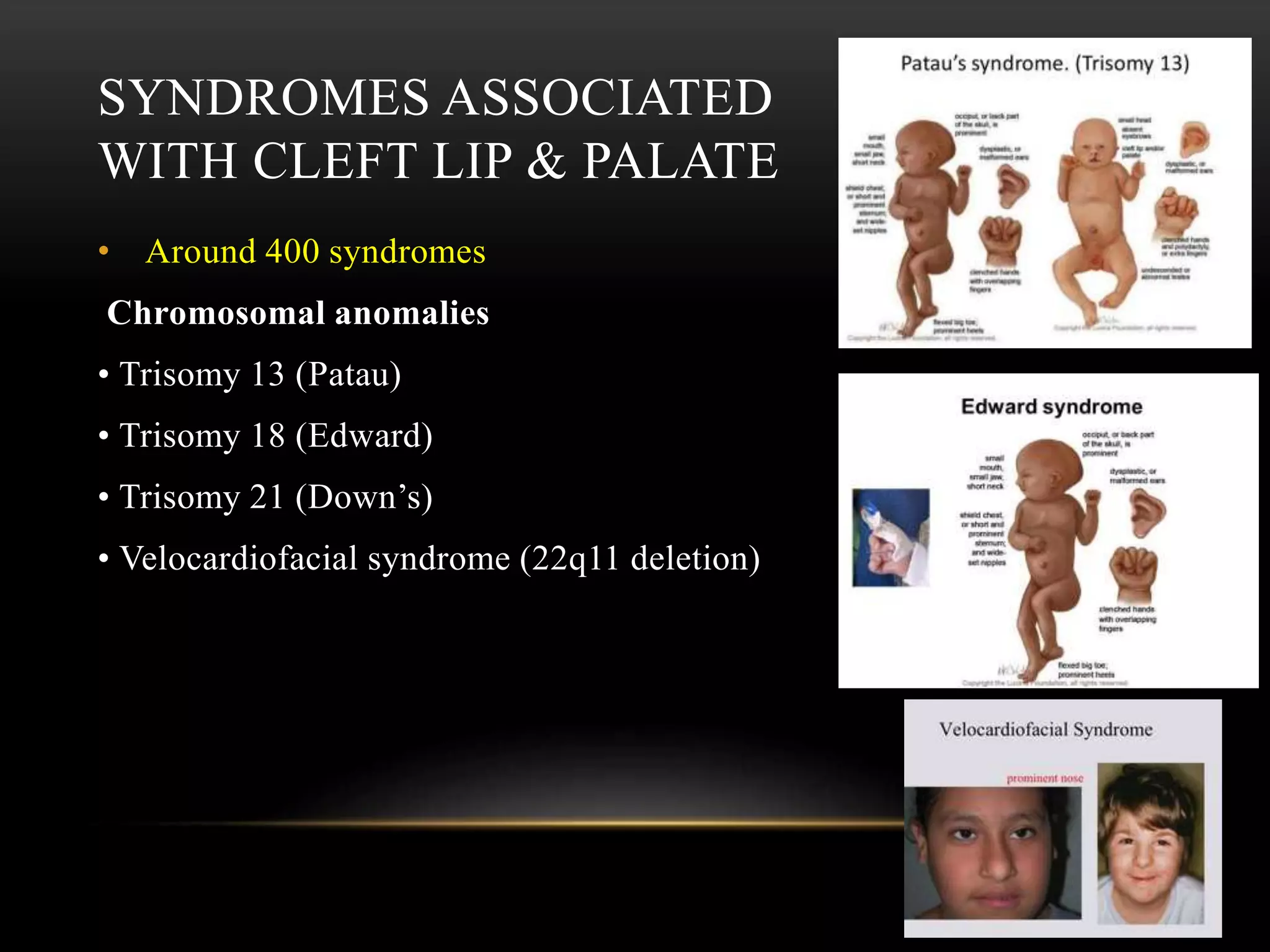 Cleft lip and palate rehabilitation - Dr Prathibha Prasad | PPTX | Pregnancy | Reproductive Health