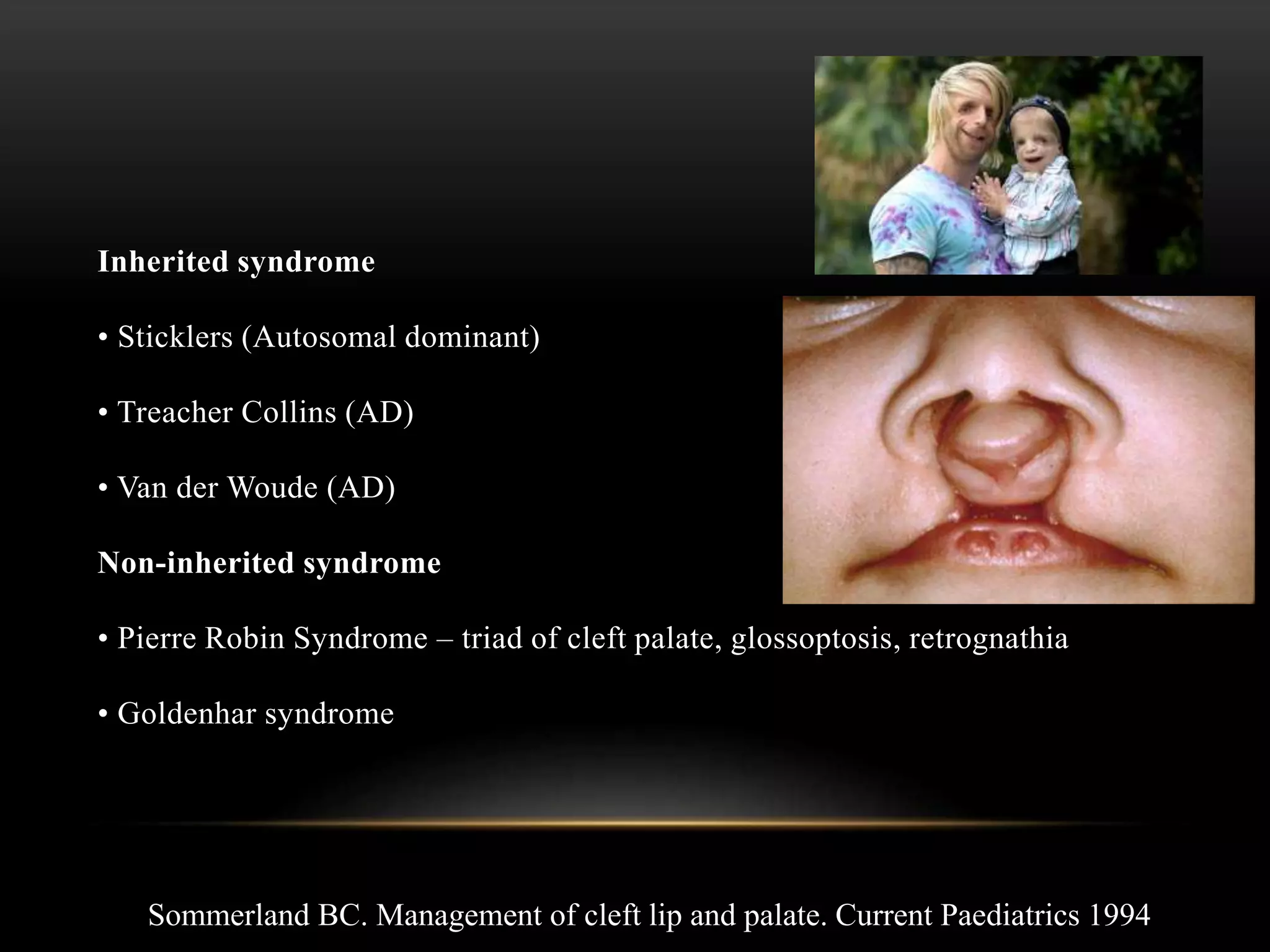 Cleft lip and palate rehabilitation - Dr Prathibha Prasad | PPTX | Pregnancy | Reproductive Health