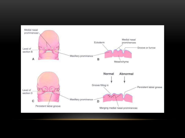 Cleft lip and palate rehabilitation - Dr Prathibha Prasad | PPTX | Pregnancy | Reproductive Health
