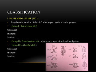 Cleft lip and palate rehabilitation - Dr Prathibha Prasad | PPTX