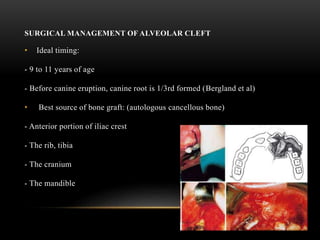 Cleft lip and palate rehabilitation - Dr Prathibha Prasad | PPTX