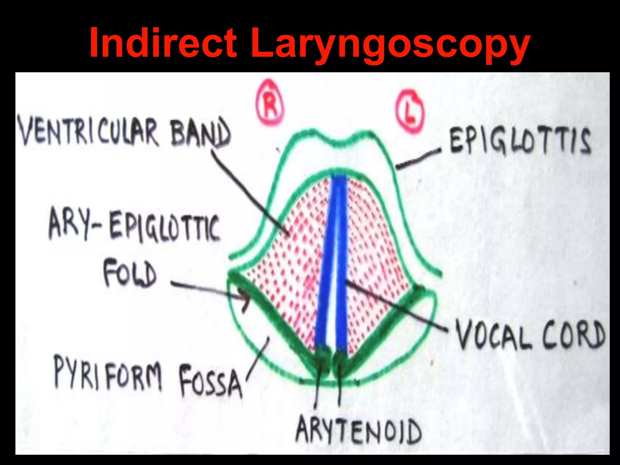 11. anatomy and physiology of larynx | PPT
