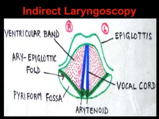 11. anatomy and physiology of larynx | PPT