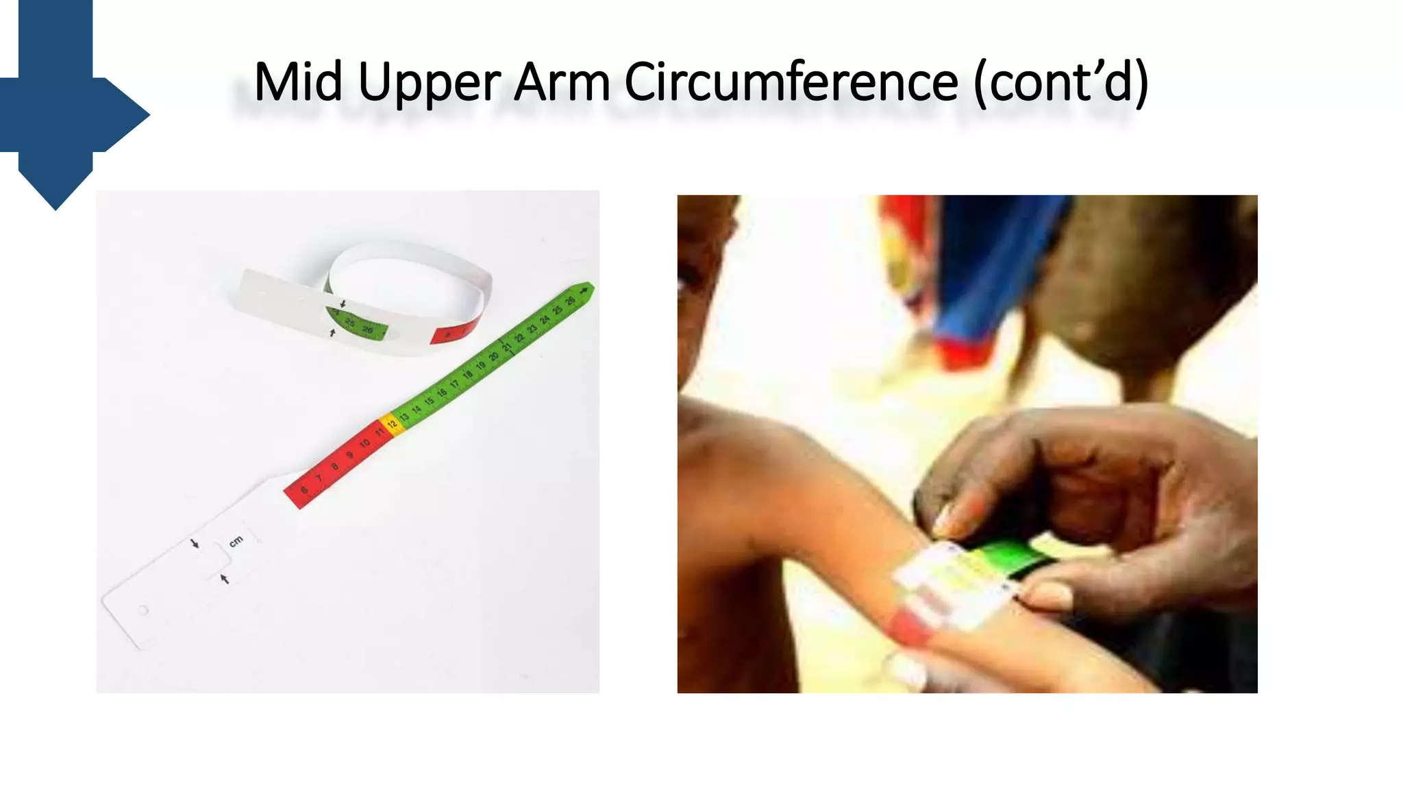 Anthropometry measurement | PPTX