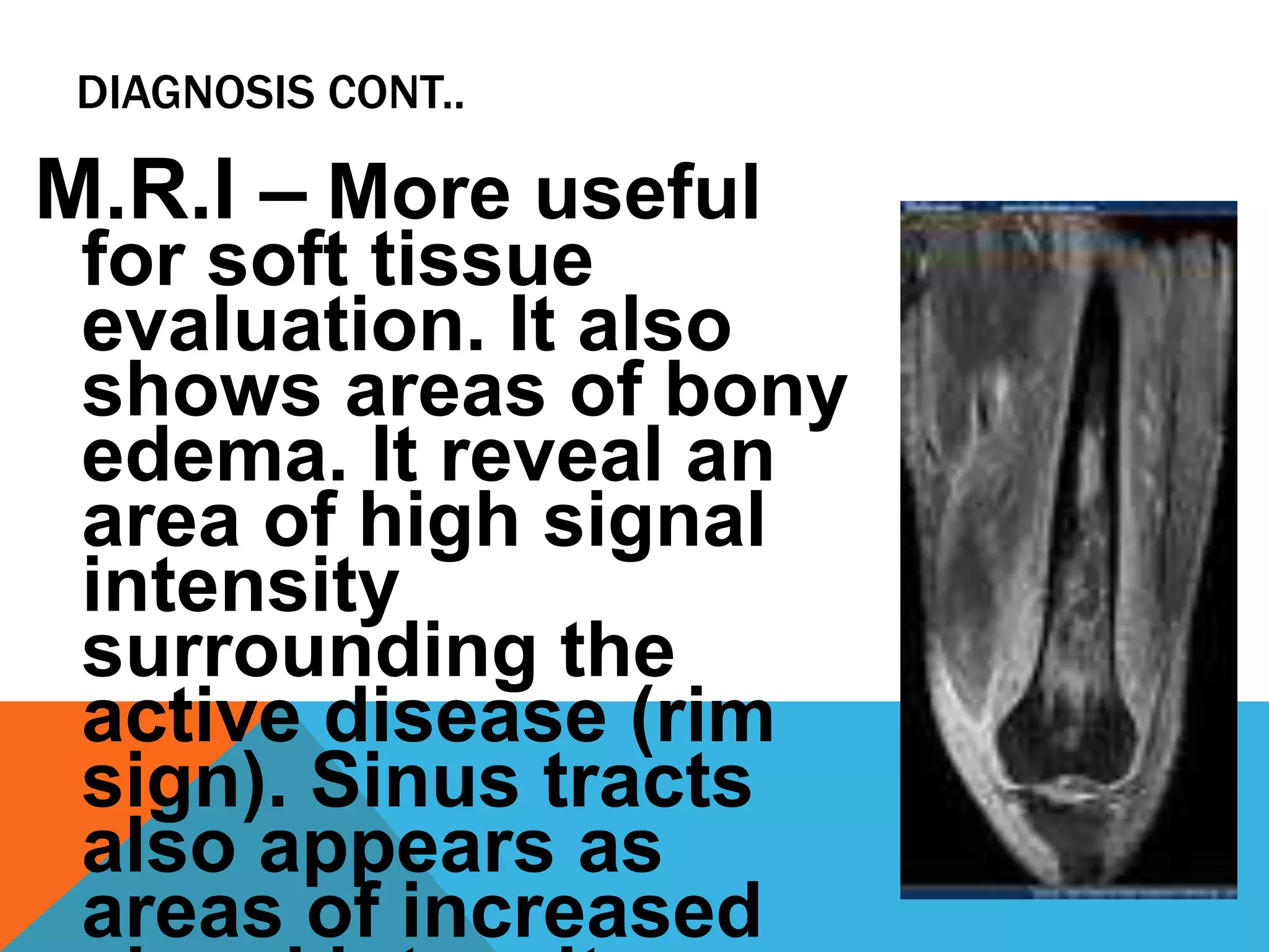Chronic osteomyelitis | PPT