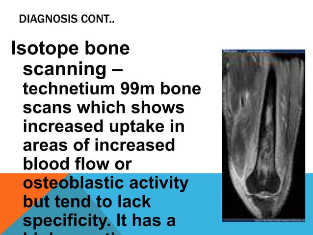 Chronic osteomyelitis | PPT