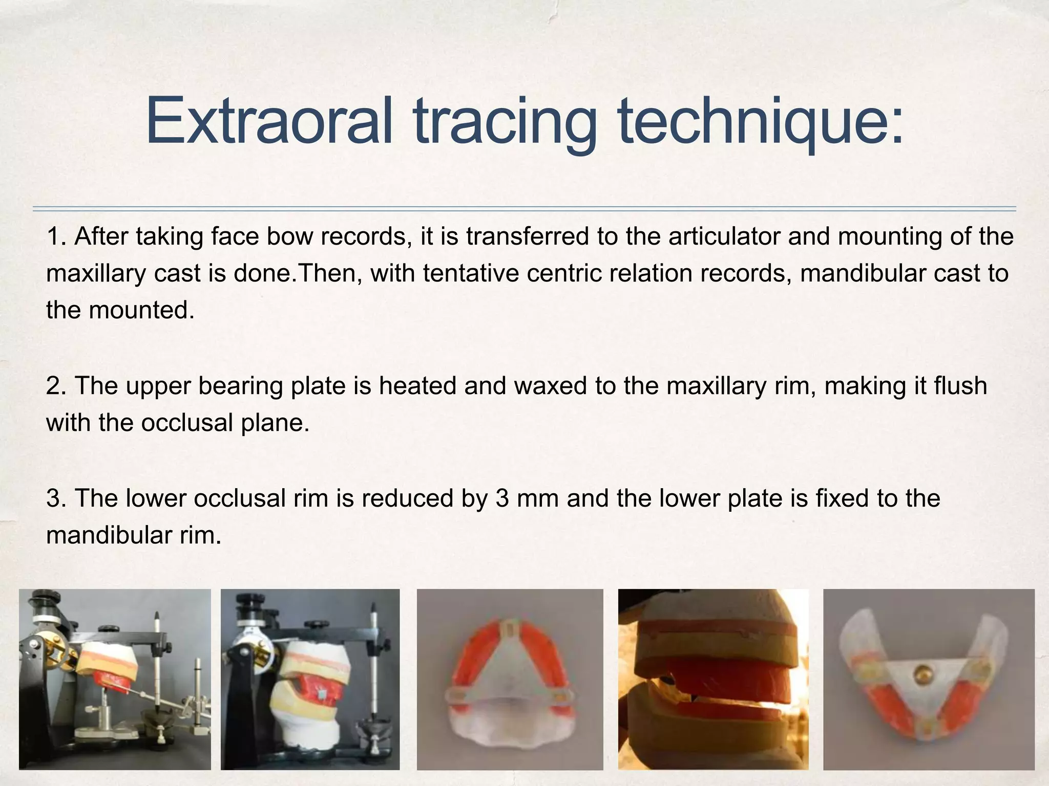 Gothic arch tracing. | PPTX
