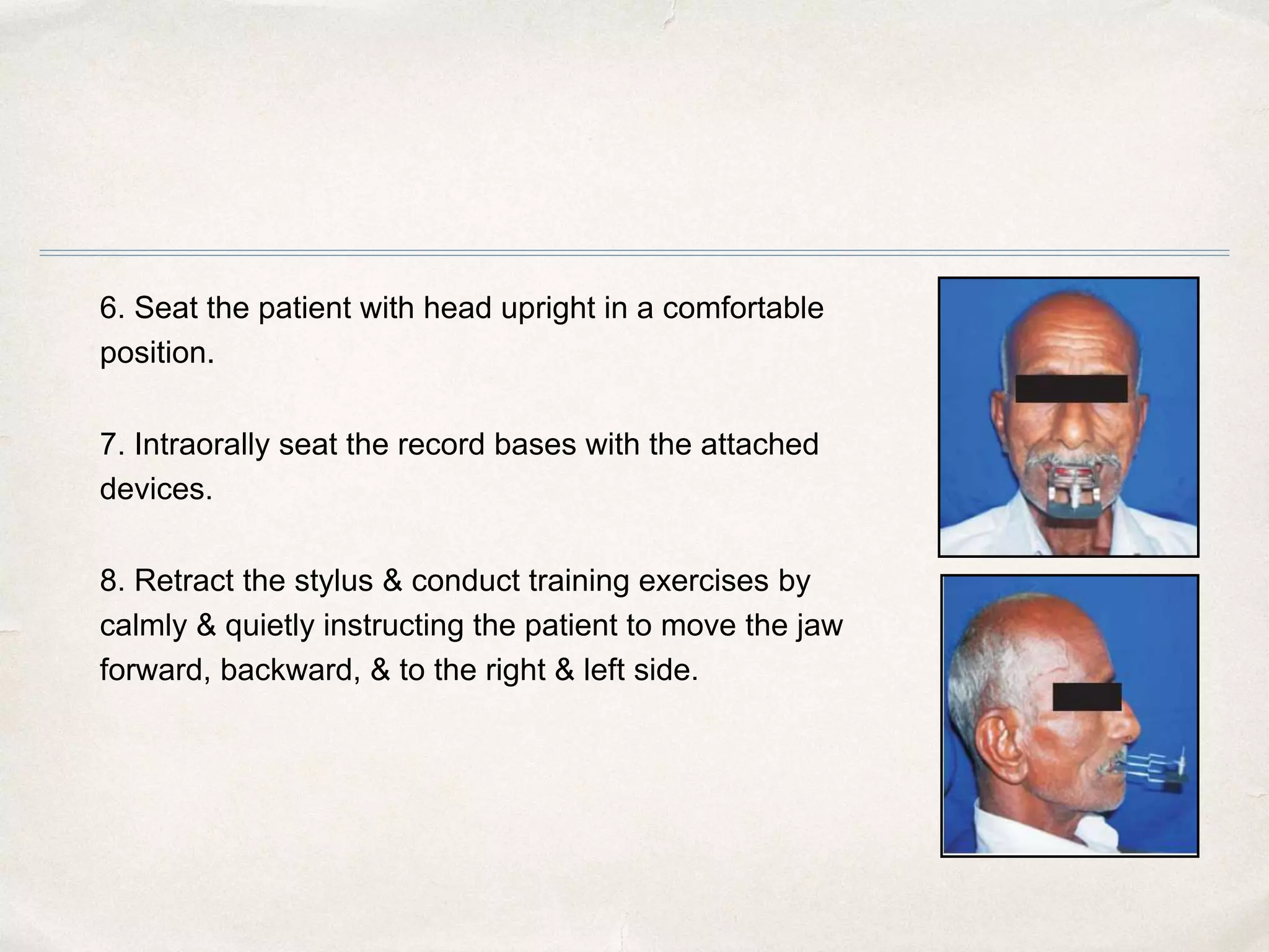 Gothic arch tracing. | PPTX