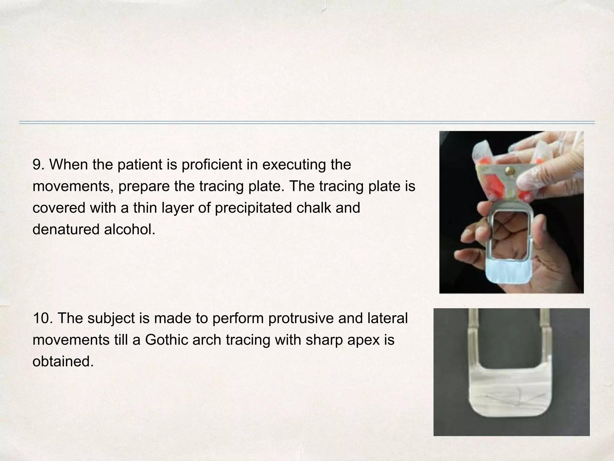 Gothic arch tracing. | PPTX