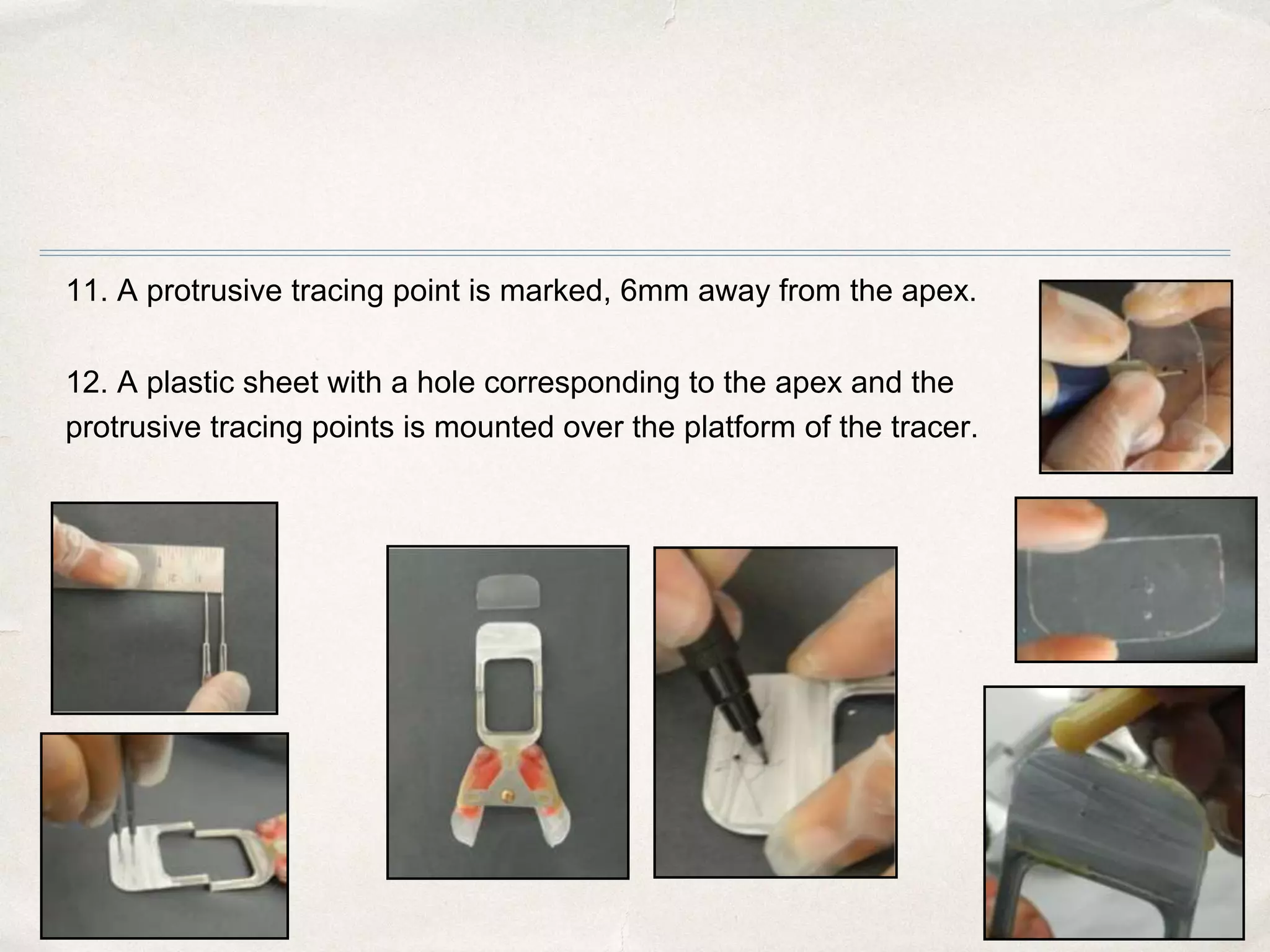 Gothic arch tracing. | PPTX