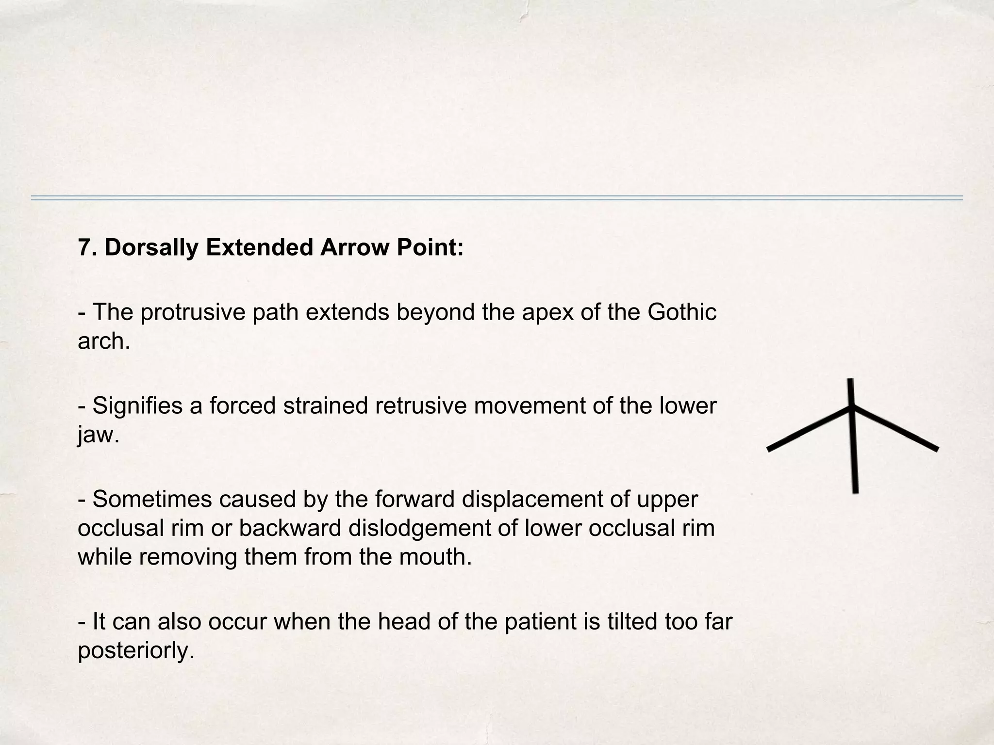 Gothic arch tracing. | PPTX