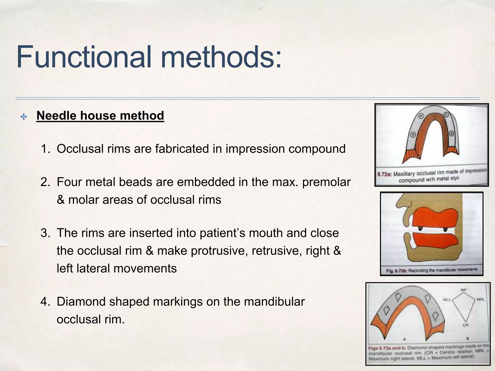 Gothic arch tracing. | PPTX
