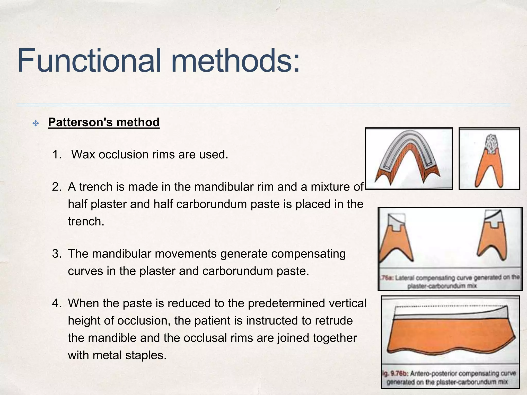Gothic arch tracing. | PPTX