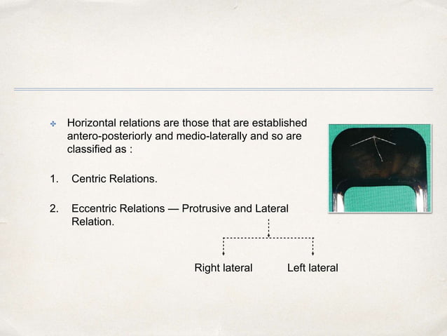 Gothic arch tracing. | PPTX | Oral care | Personal Care