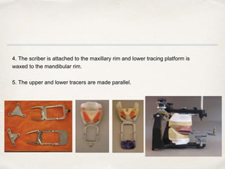 Gothic arch tracing. | PPTX