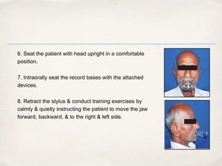 Gothic arch tracing. | PPTX