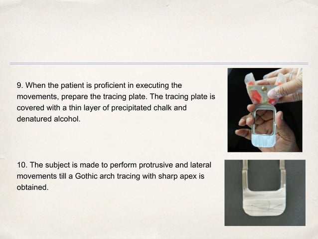 Gothic arch tracing. | PPTX | Oral care | Personal Care