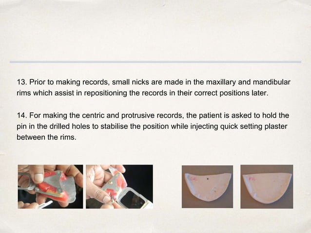 Gothic arch tracing. | PPTX | Oral care | Personal Care