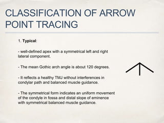 Gothic arch tracing. | PPTX | Oral care | Personal Care