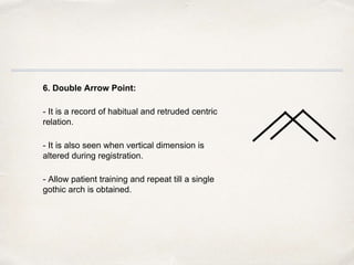 Gothic arch tracing. | PPTX