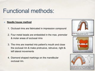 Gothic arch tracing. | PPTX