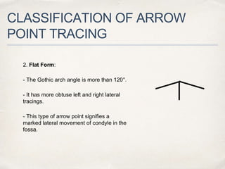 Gothic arch tracing. | PPT