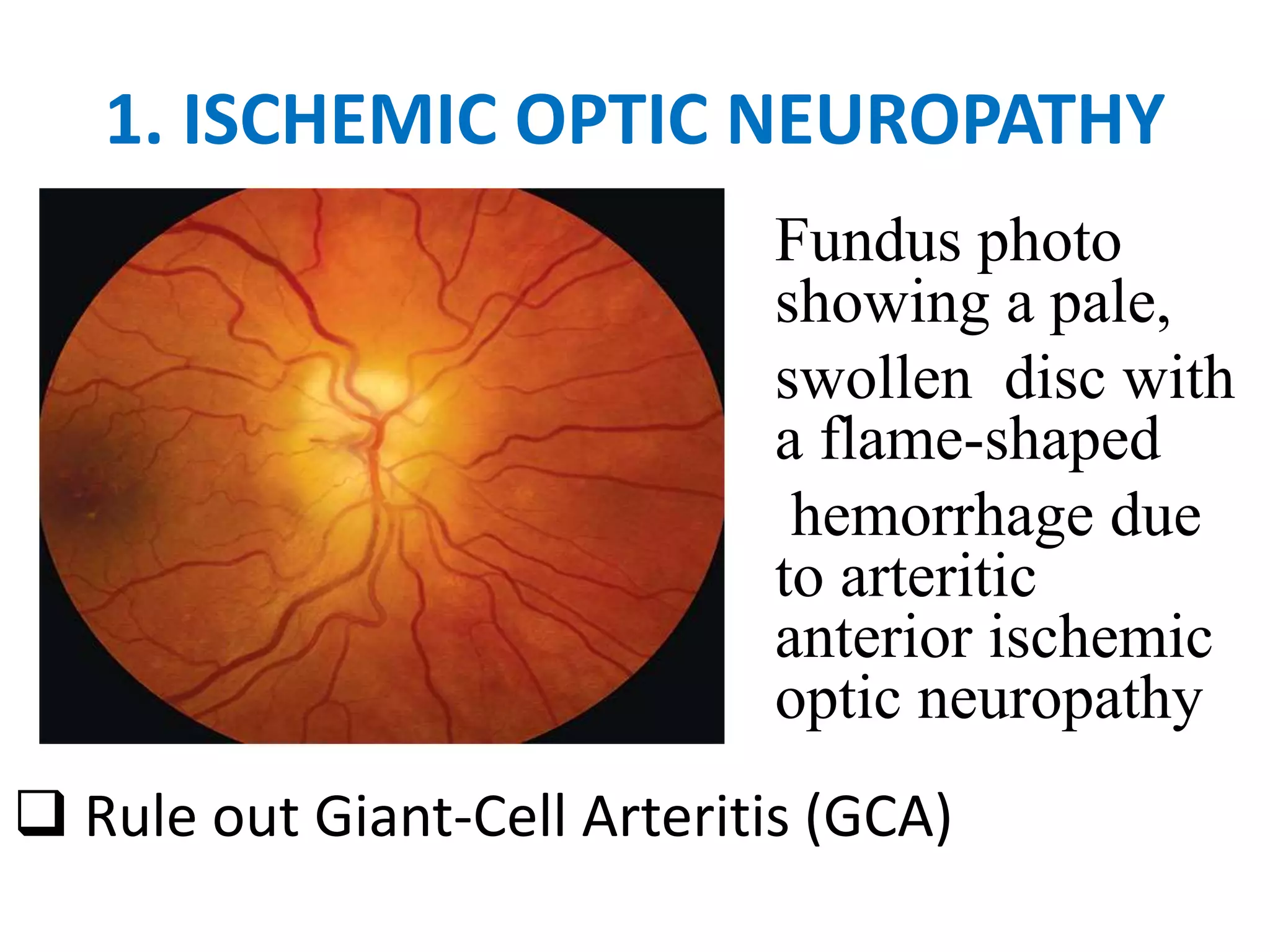 11. ocular emergencies and their prevention | PPTX