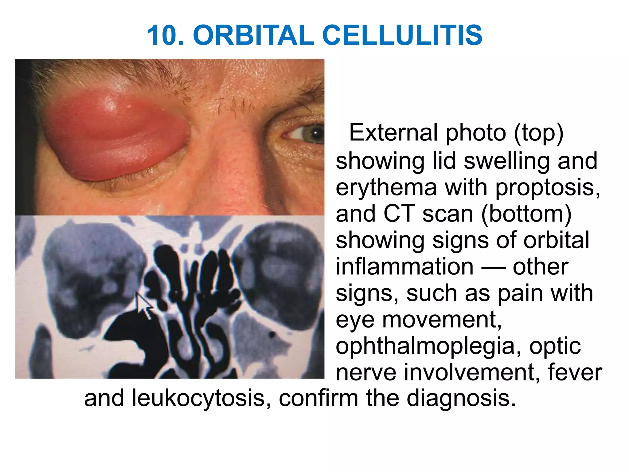 11. ocular emergencies and their prevention | PPTX
