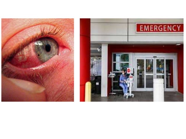 11. ocular emergencies and their prevention | PPTX | Death, Injury, or ...