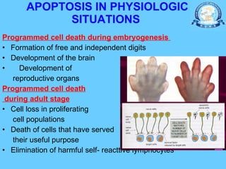 11.20 (dr. yasmeen hashim) apoptosis (mechanism in normal tissues ...
