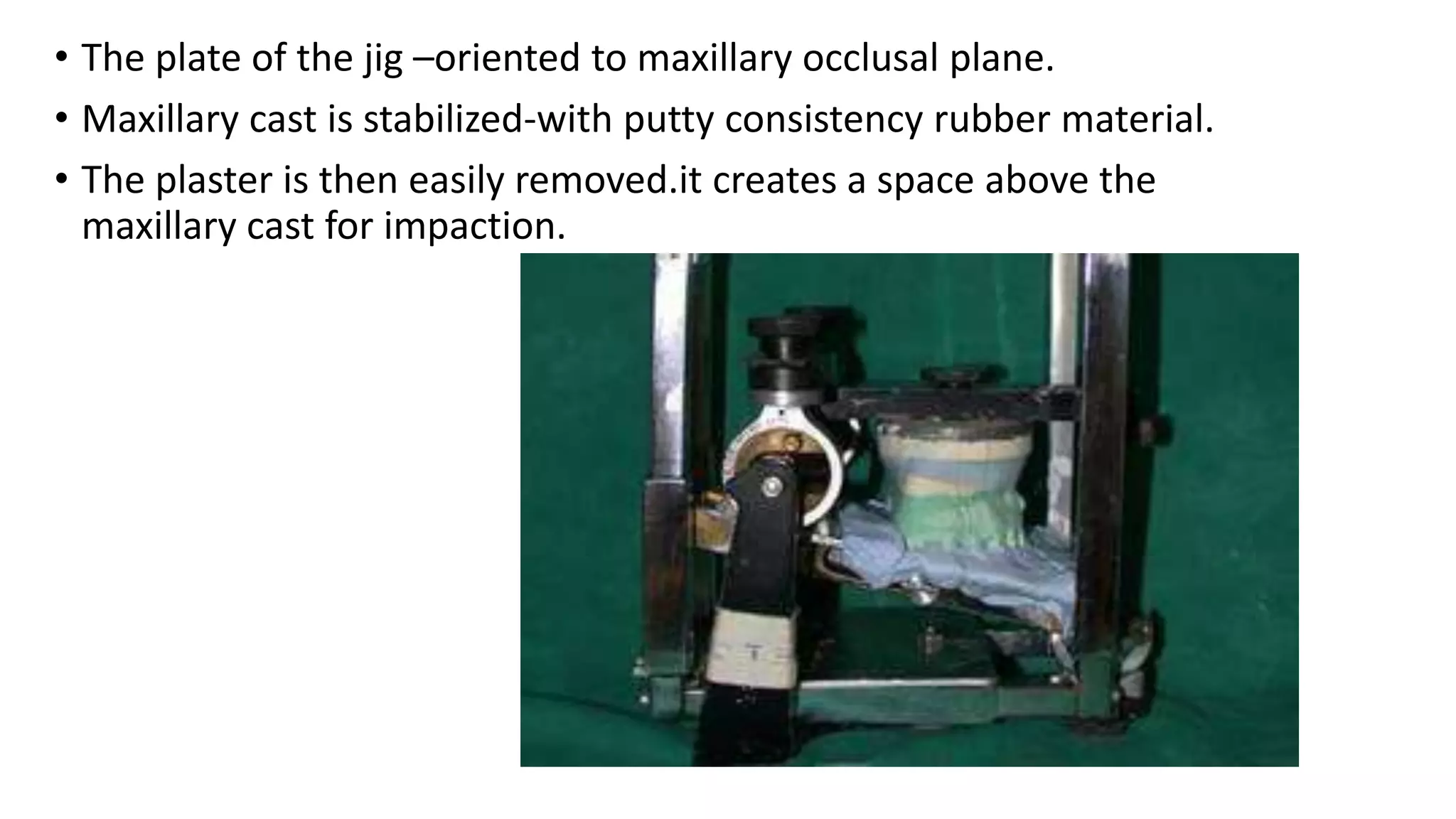 SPLINT FABRICATION AND POST SURGICAL ORTHODONTICS | PPTX