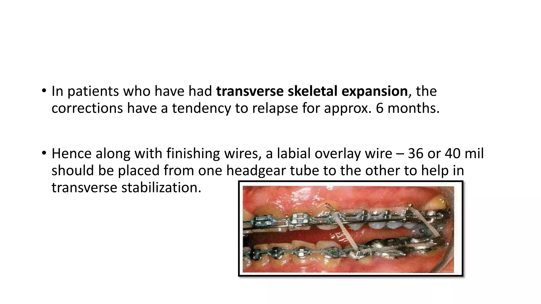 SPLINT FABRICATION AND POST SURGICAL ORTHODONTICS | PPTX
