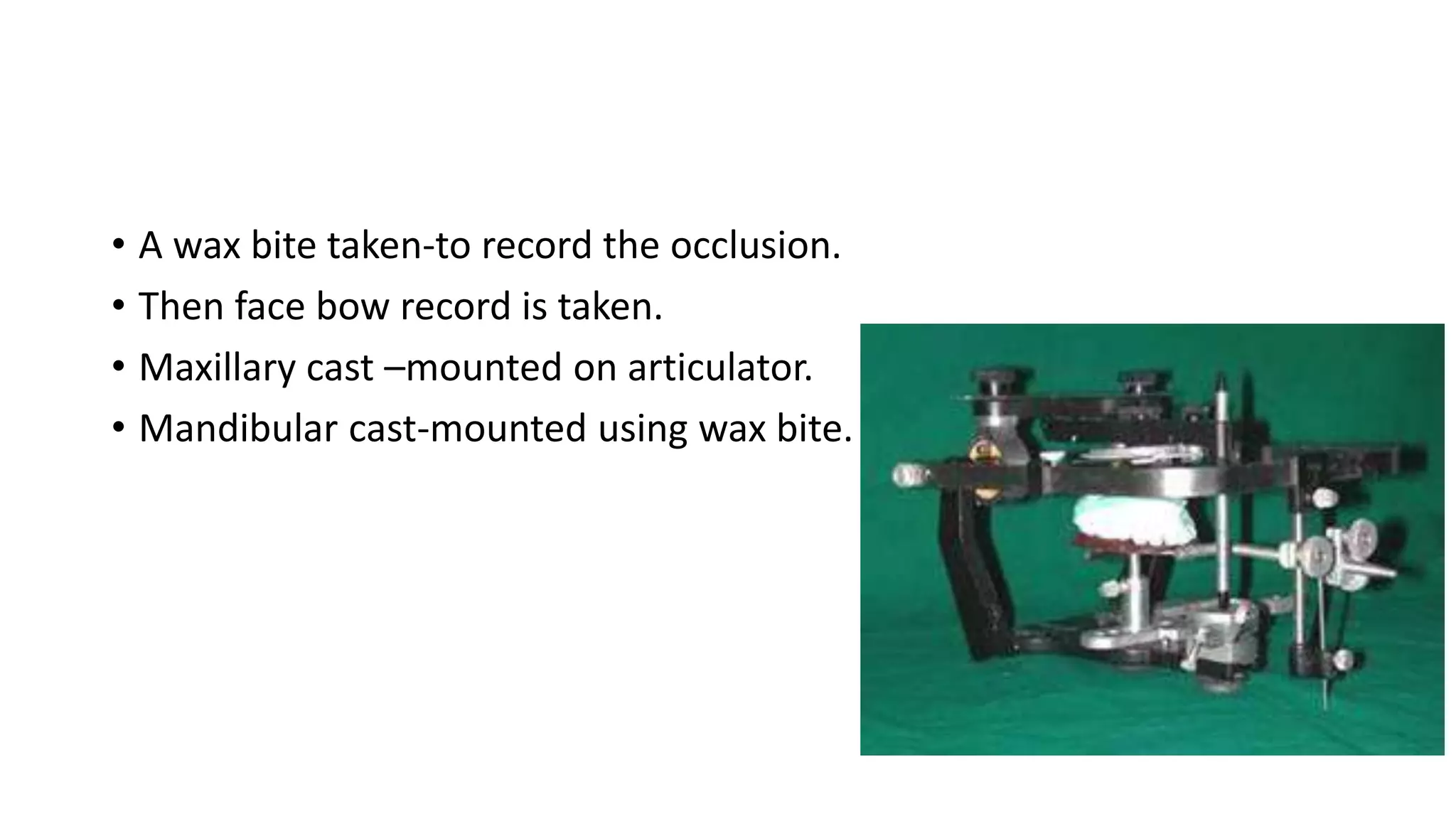 SPLINT FABRICATION AND POST SURGICAL ORTHODONTICS | PPTX