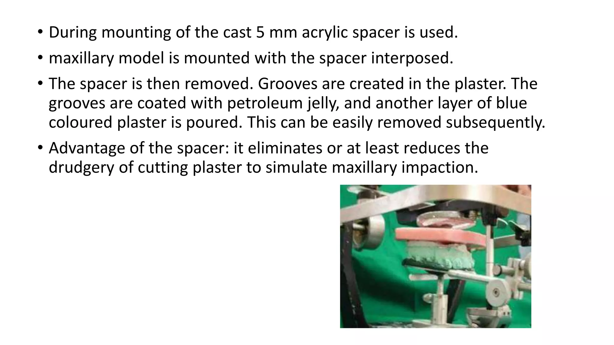 SPLINT FABRICATION AND POST SURGICAL ORTHODONTICS | PPTX