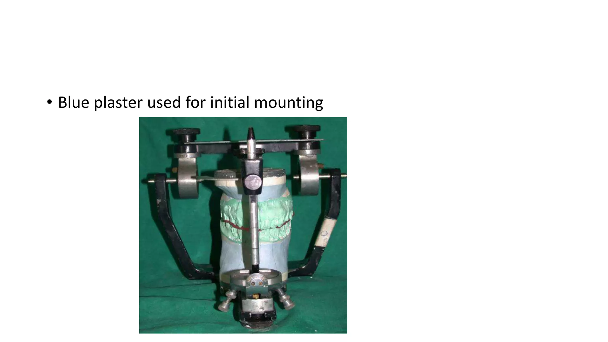 SPLINT FABRICATION AND POST SURGICAL ORTHODONTICS | PPTX