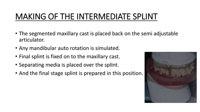 SPLINT FABRICATION AND POST SURGICAL ORTHODONTICS | PPTX