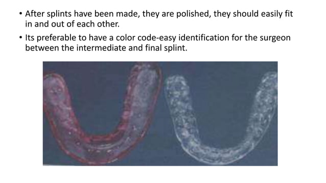 SPLINT FABRICATION AND POST SURGICAL ORTHODONTICS | PPTX
