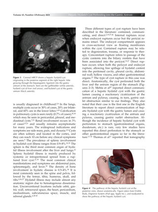 Spontaneous Rupture of a Hepatic Hydatid Cyst Perforating into the ...
