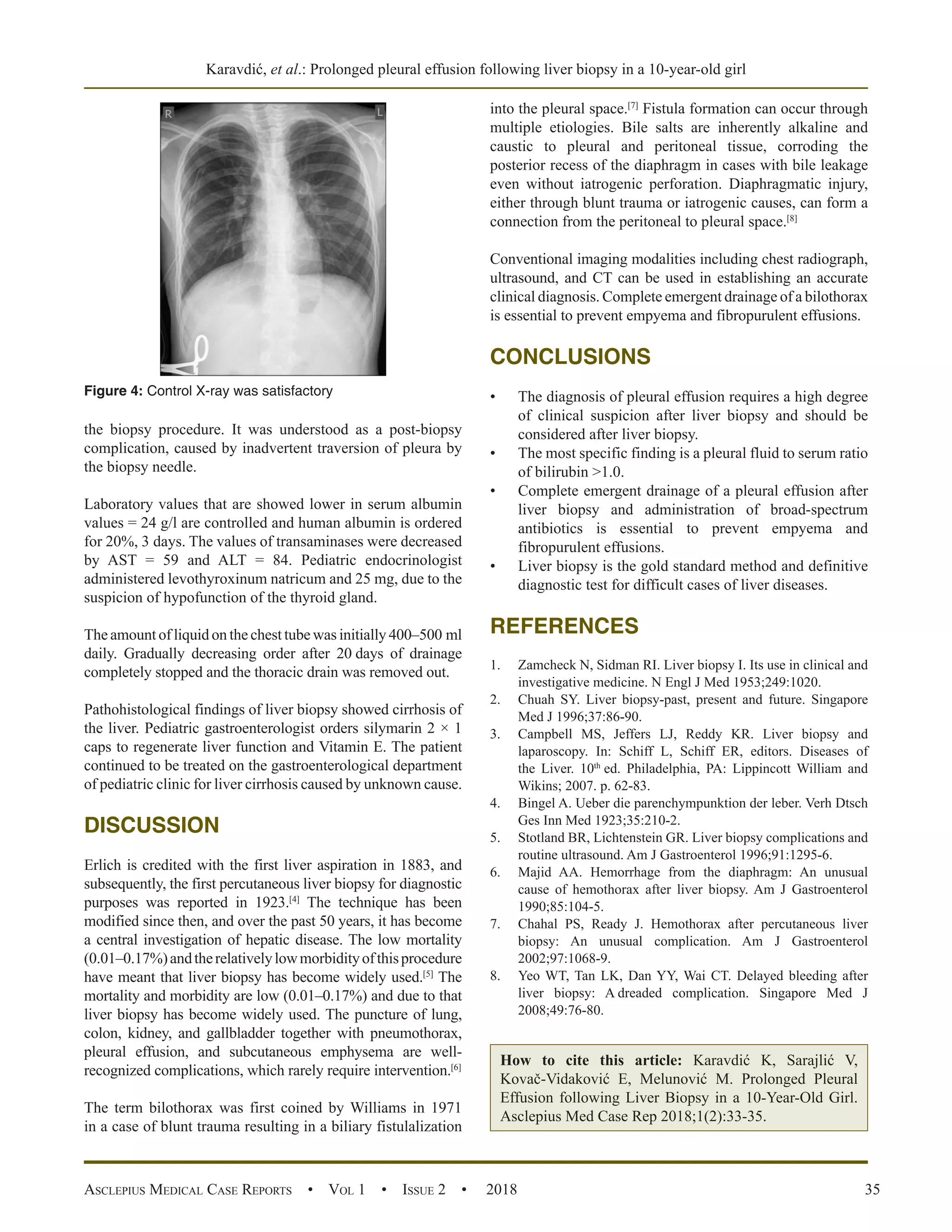 Prolonged Pleural Effusion following Liver Biopsy in a 10-Year-Old Girl ...