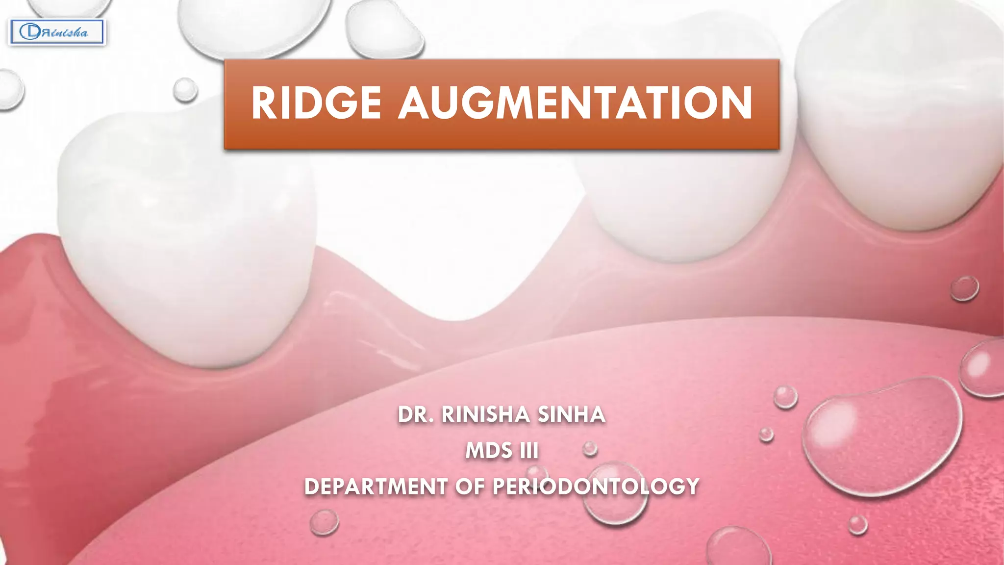 Ridge augmentation | PPTX