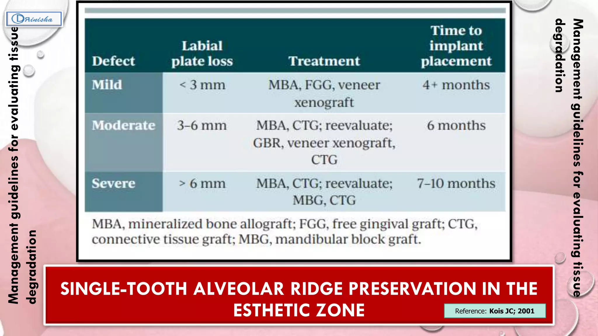 Ridge augmentation | PPTX