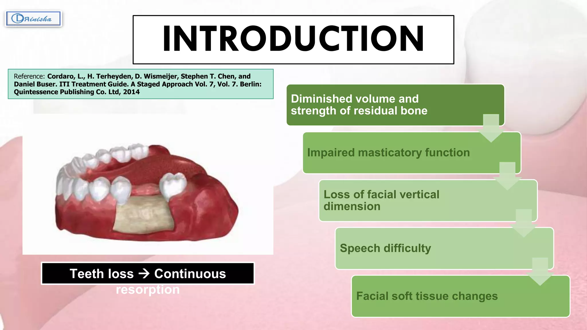 Ridge augmentation | PPTX
