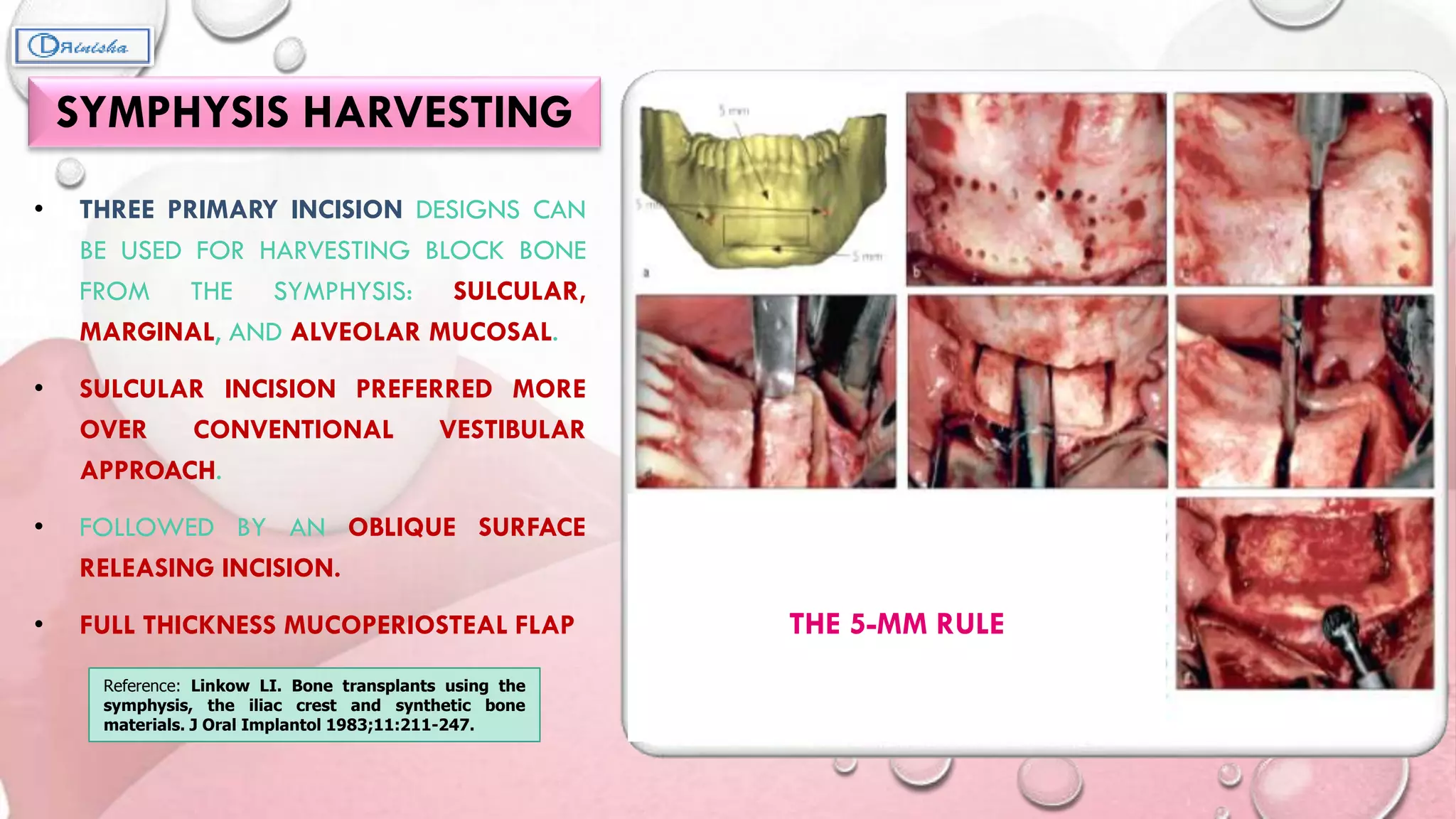 Ridge augmentation | PPTX