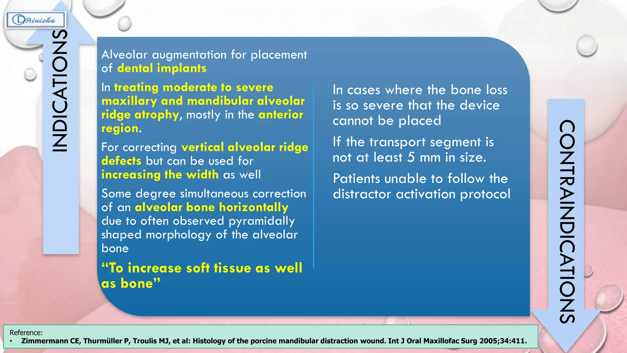 Ridge augmentation | PPTX