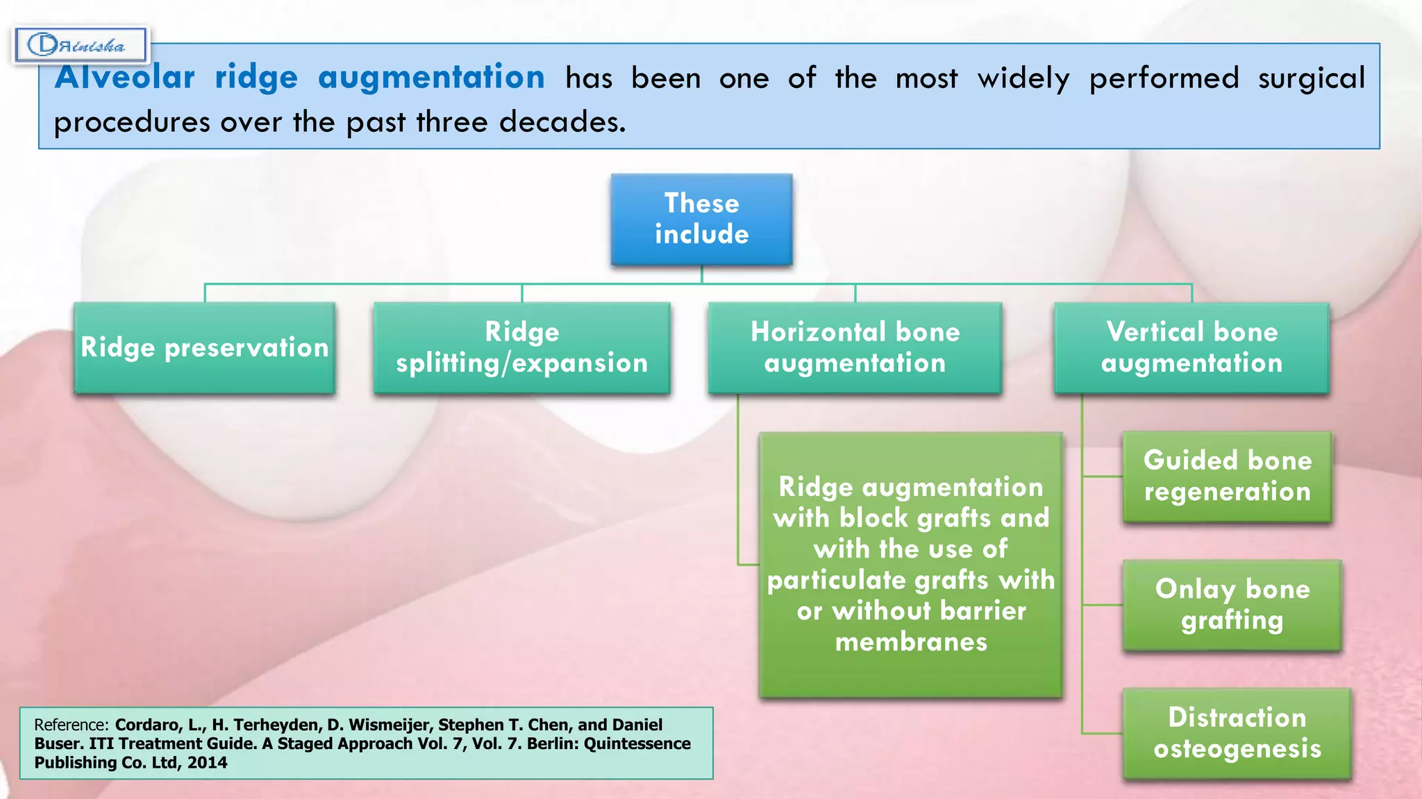 Ridge augmentation | PPTX