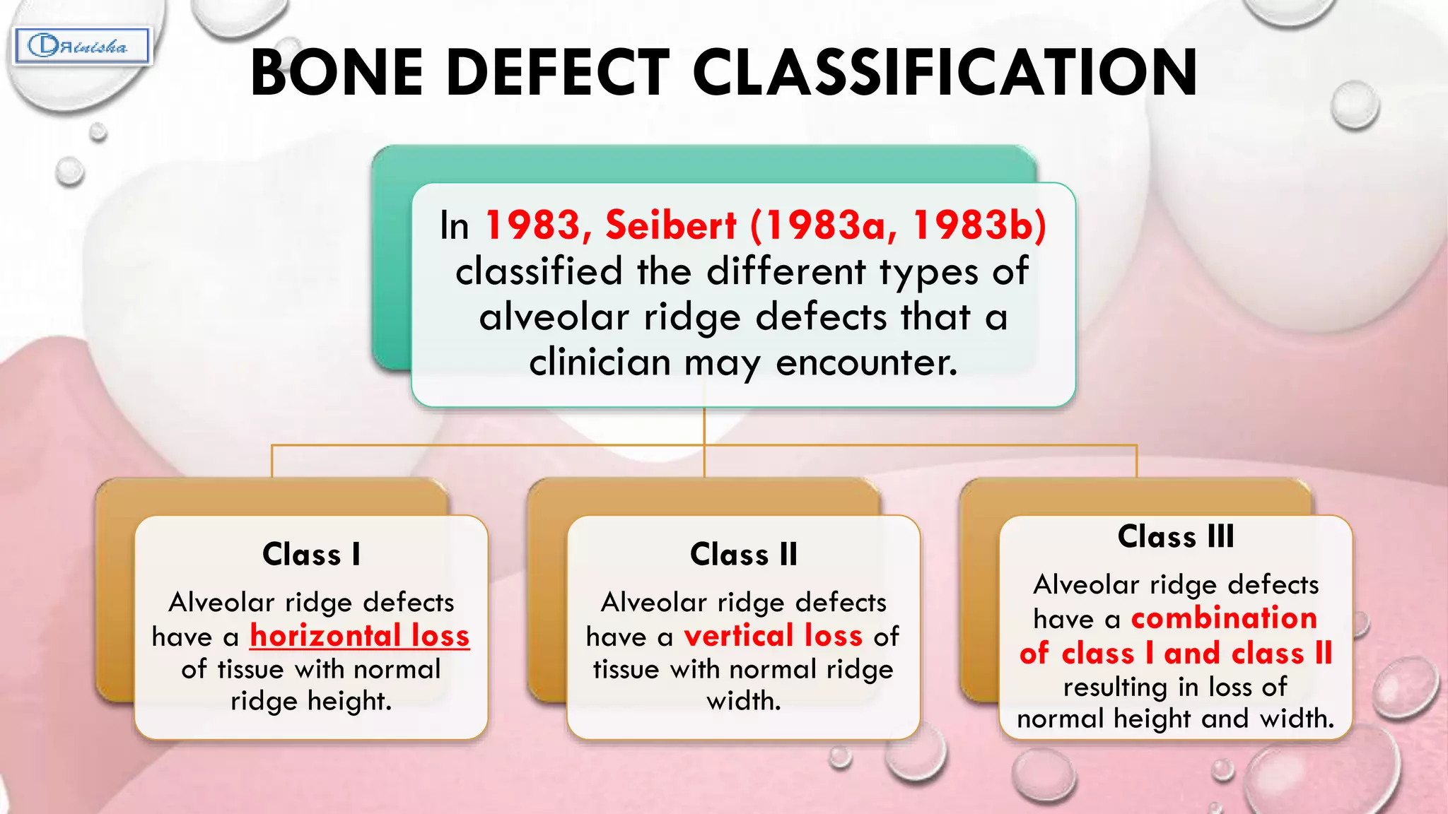 Ridge augmentation | PPTX