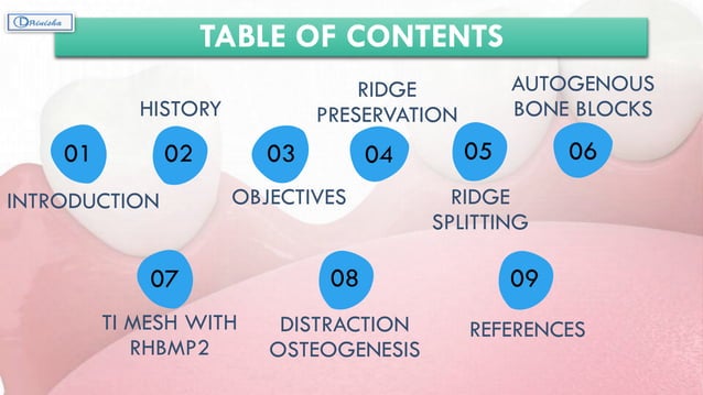 Ridge augmentation | PPTX