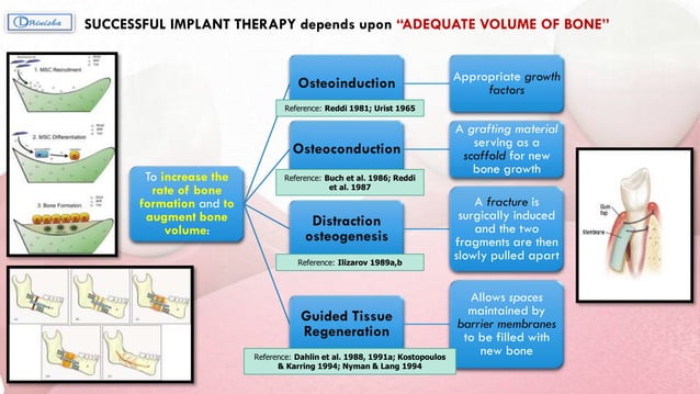 Ridge augmentation | PPTX